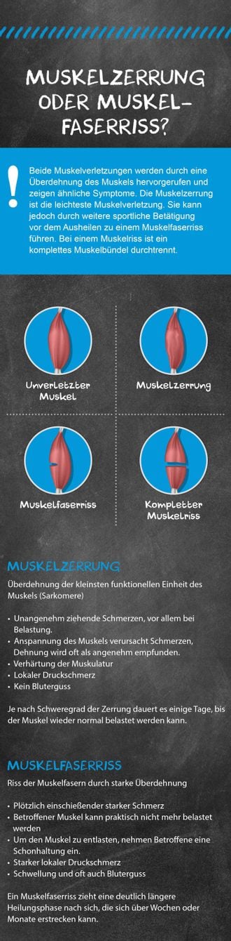 zerrungen-infografik | Zerrungen